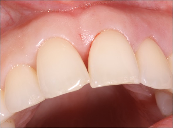Periodontal cases – Dr James Chesterman